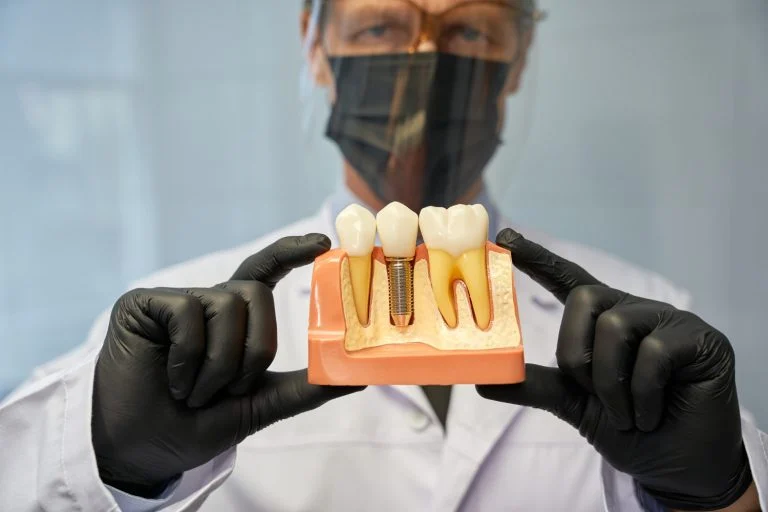 Choosing the Right Tooth Implant Size - Honolulu Smile Designs